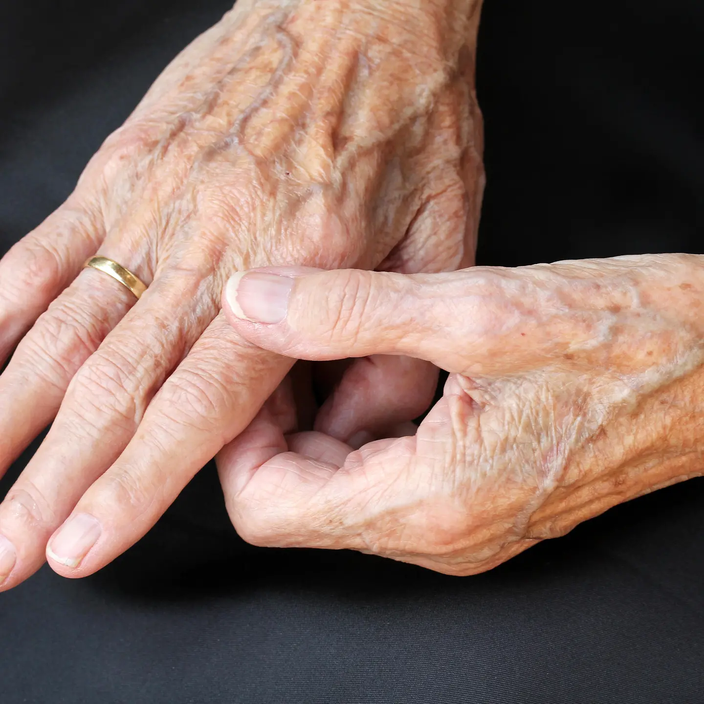 Gicht – schmerzhaft, aber vermeidbar | BARMER